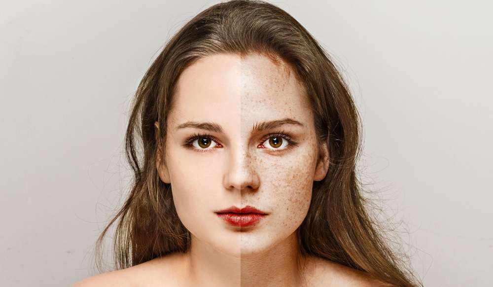 Treat Sun Damage, Pigmentation and Aged Skin